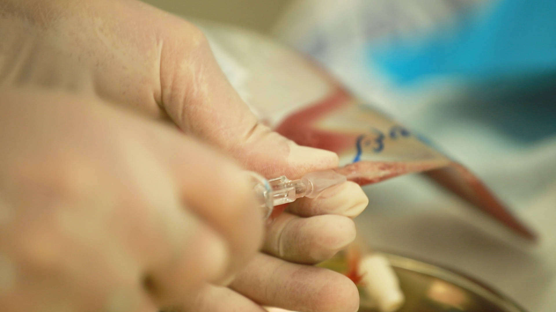 NNUH Successfully Performs Over 300 Bone Marrow Transplant Surgeries ...